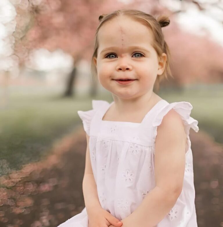 The girl with the birthmark then and now!” This is what the child looks ...