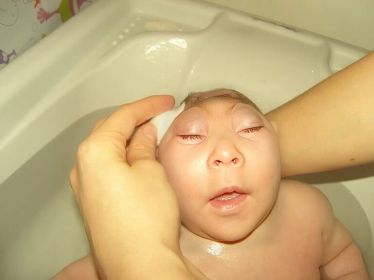 A baby born without a skull is trying to survive, watch the video and ...